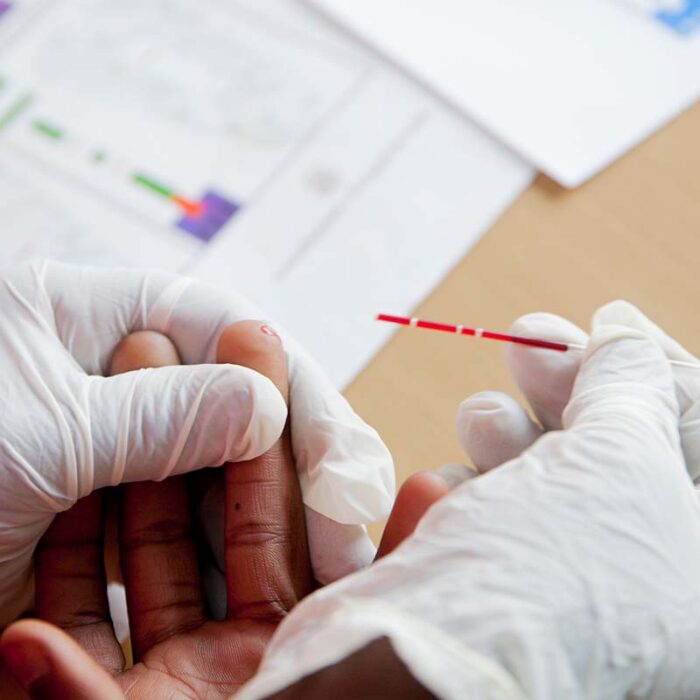 HIV service integration - FHI 360